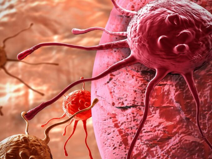 rakovina dutiny ústní - Zdravestravovani.eu