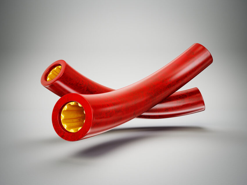 Příznaky ucpání tepen, které může mít fatální následky ...