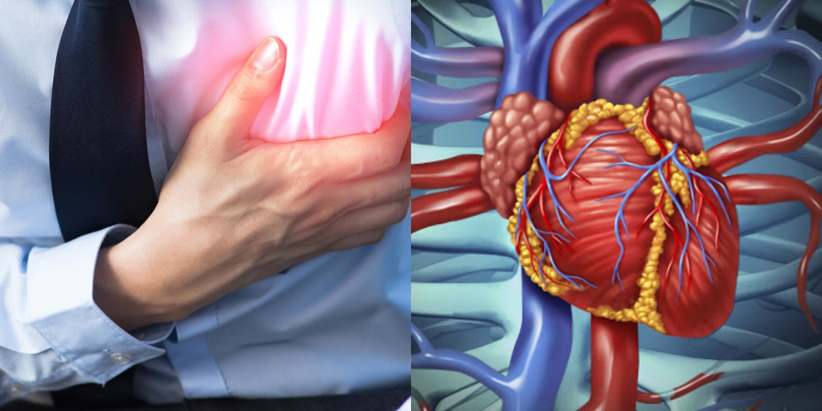Signály koronární srdeční choroby | Zdravestravovani.eu