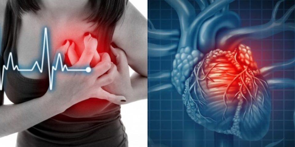 Jak poznáte příznaky infarktu | Zdravestravovani.eu