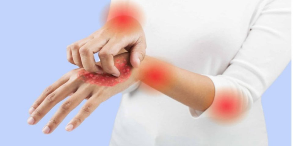 Artritida: Jakými faktory si ji můžete zhoršit | Zdravestravovani.eu