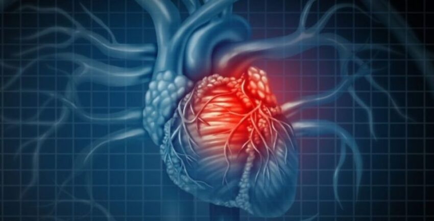 Nejčastější příznaky infarktu myokardu | Zdravestravovani.eu