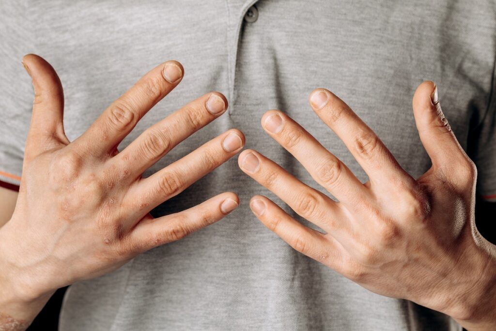 Příčiny necitlivosti prstů, které je nutné brát vážně a léčit je