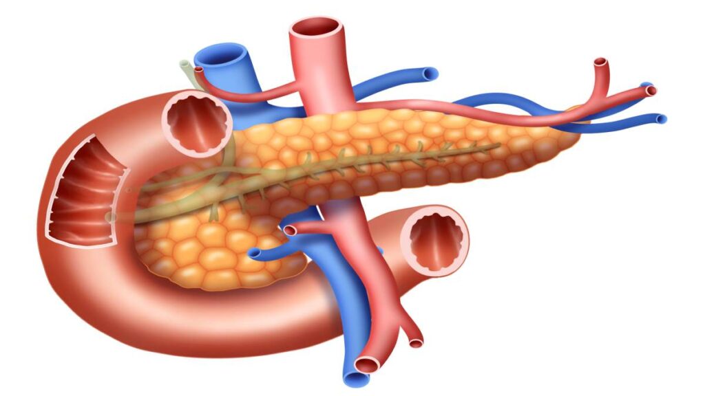 Příznaky a léčba rakoviny slinivky | Zdravestravovani.eu
