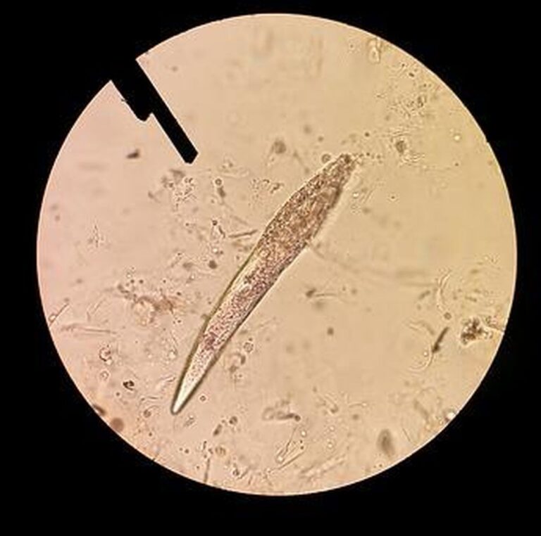 Napadení pokožky nebezpečným trudníkem | Zdravestravovani.eu