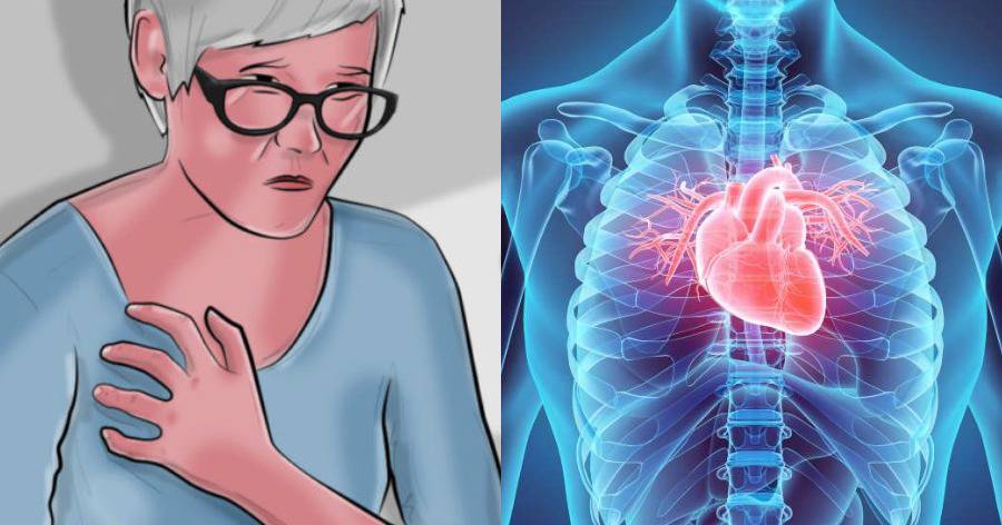 Jaké jsou příznaky infarktu u žen | Zdravestravovani.eu
