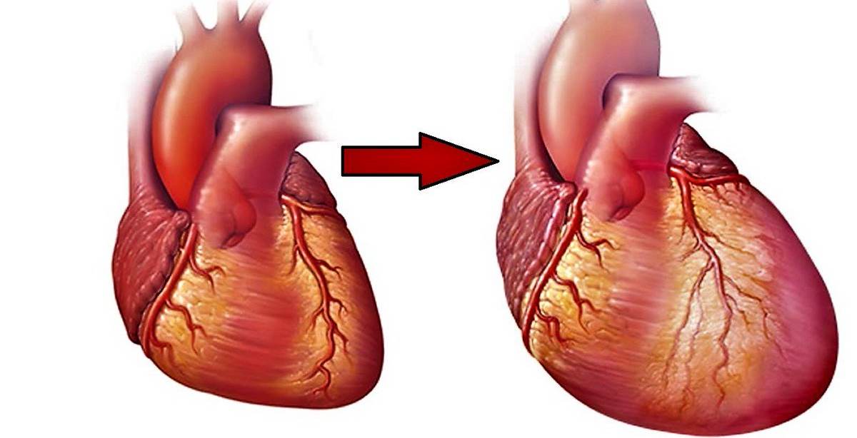 Kardiologové varují: tyto příznaky předznamenávají srdeční infarkt