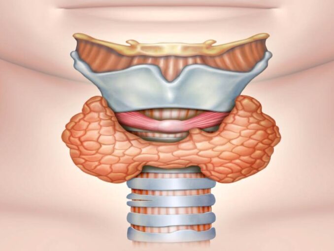 Tajemná nemoc štítné žlázy: Příznaky Hashimotovy choroby