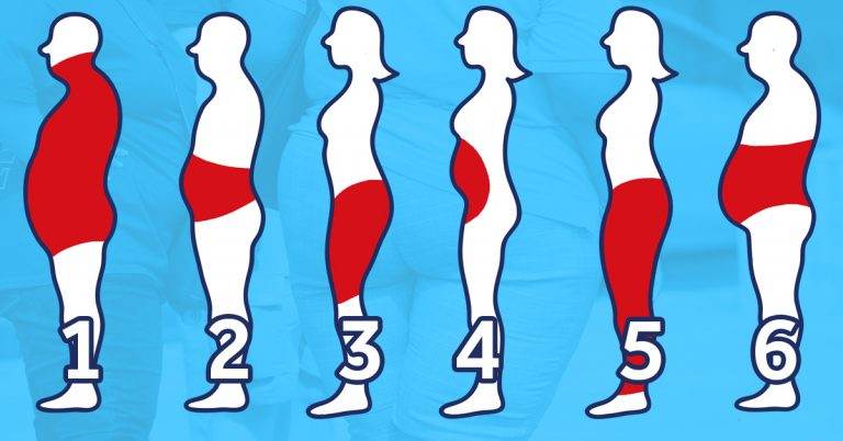 6 typů obezity a jak se zbavit nechtěného tuku