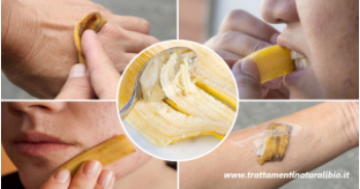 Banánové slupky mají mnohostranná využití, která často oceníte