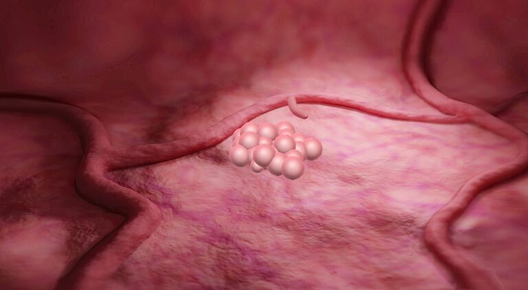 Potenciálně nebezpečné mazové cysty: Jak je poznat a léčit