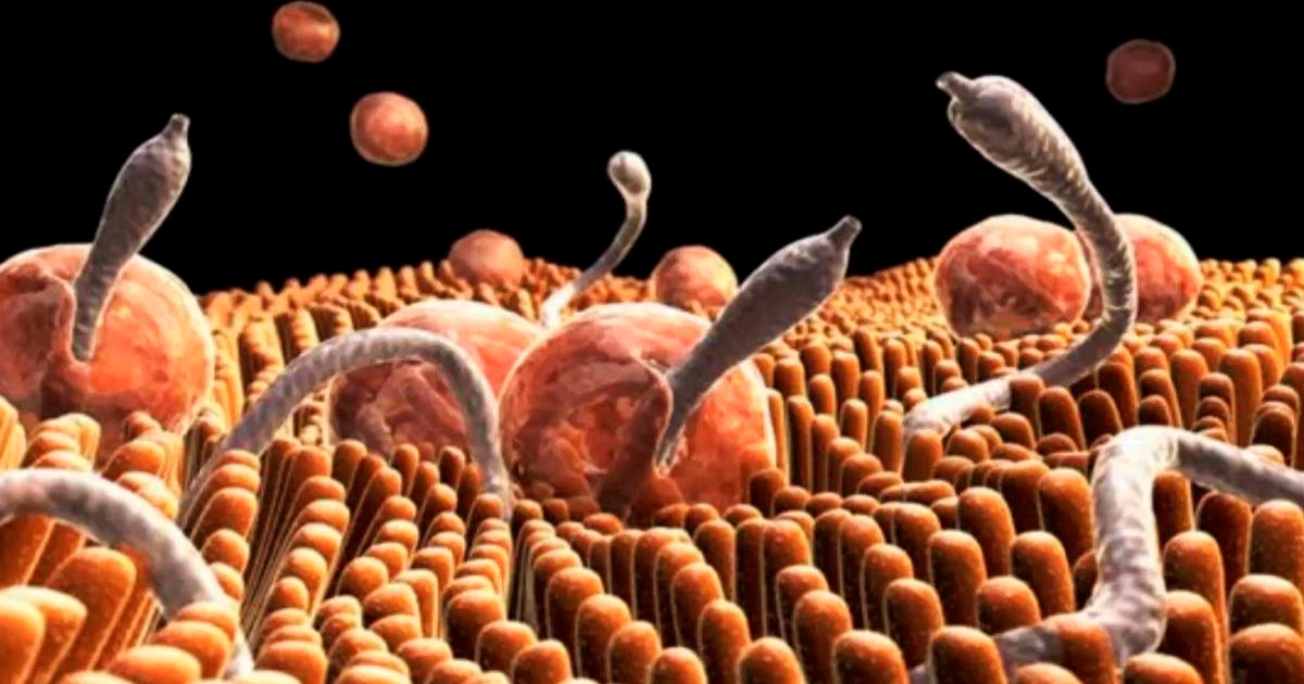 Jednoduché způsoby, jak se zbavit parazitů v organismu