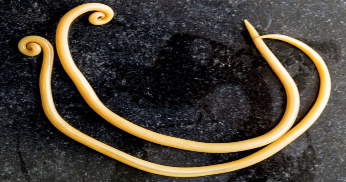 Nejčastější příznaky parazitů v těle a jak se můžete nakazit