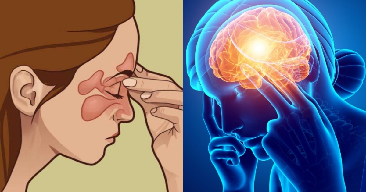 Co způsobuje zánět dutin a jak se ho zbavit bez větších potíží