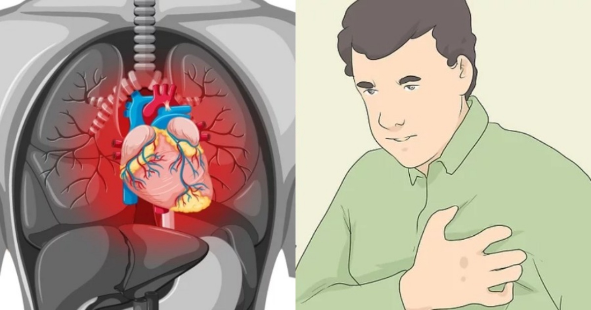 Srdeční infarkt a typické příznaky, které ho nejčastěji doprovází