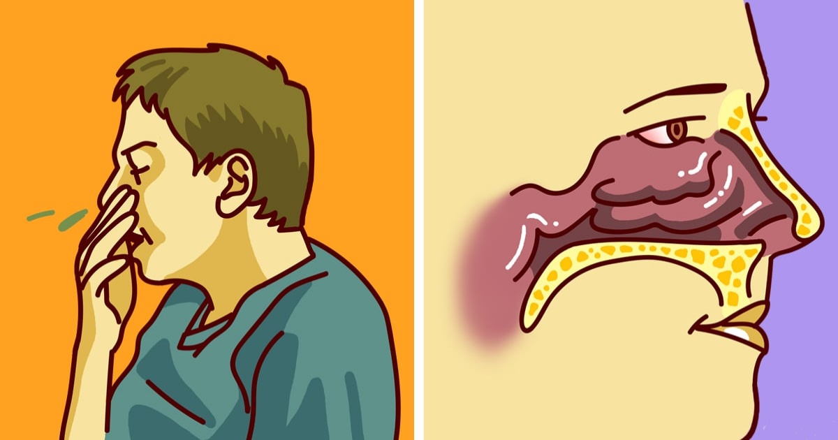 Hlen reaguje do 2 MINUT na tento levný přírodní vypuzovač