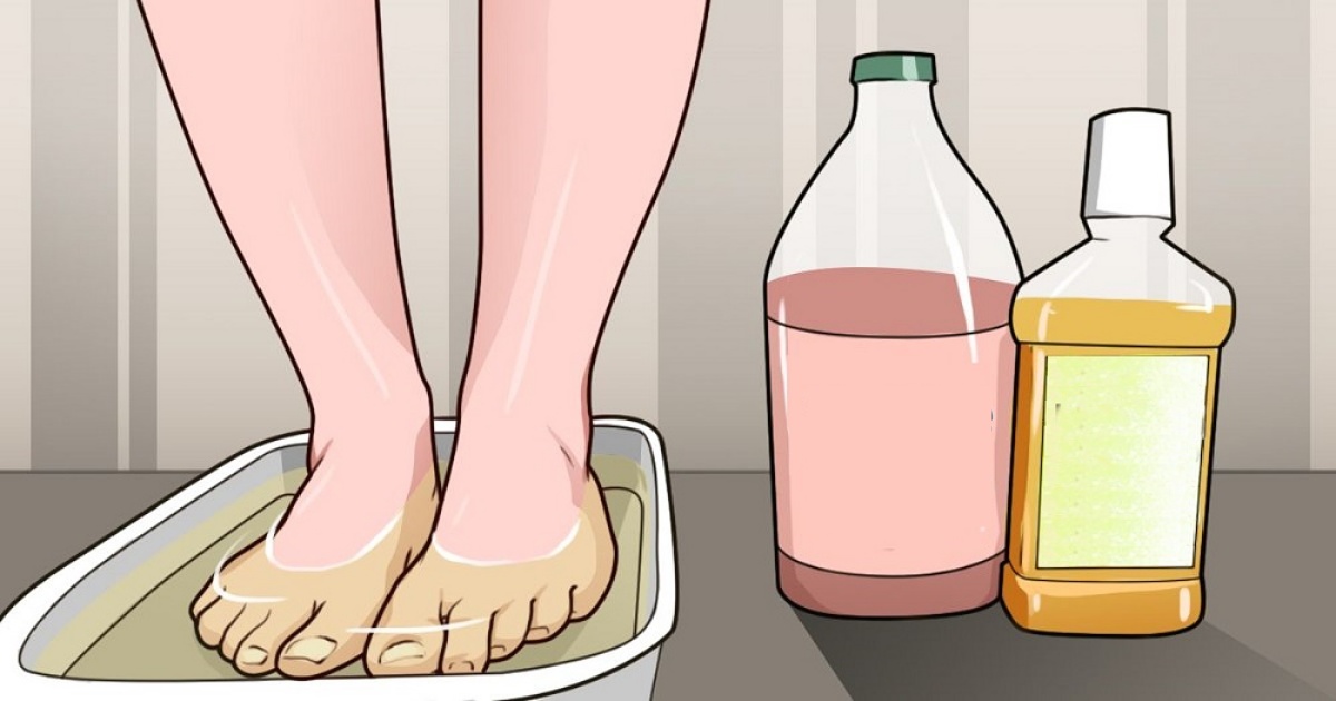 Atletická noha a účinná domácí léčba tohoto bolavého problému