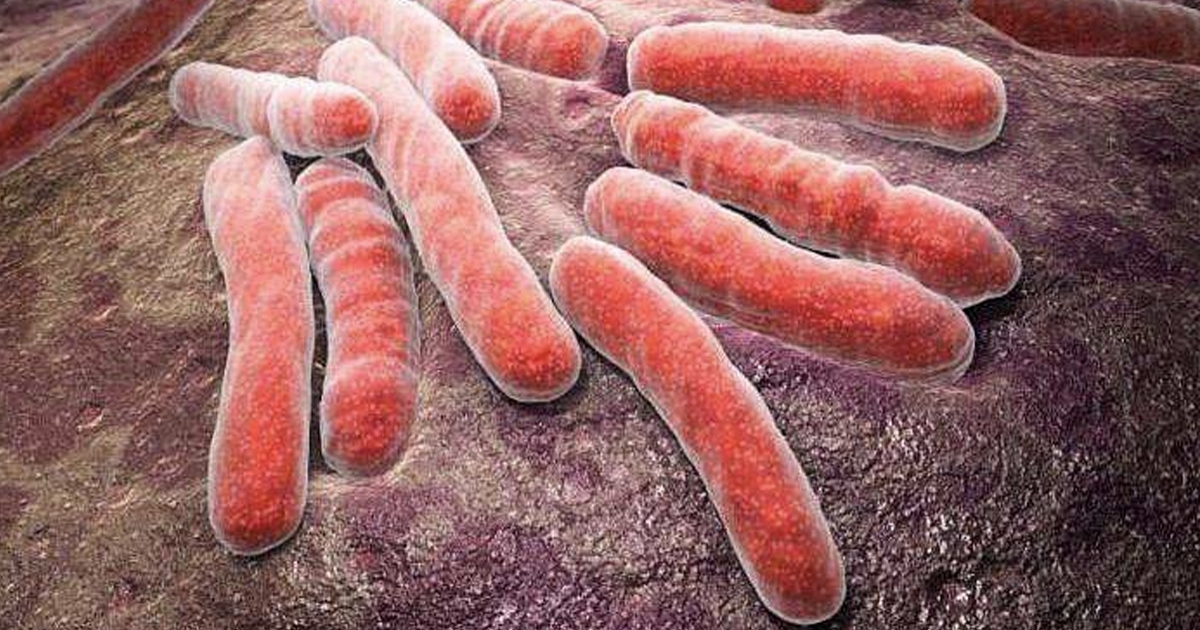 Erysipel je tichý zabiják, kterého si většina lidí plete s celulitidou