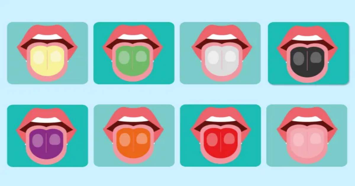 Tyto neobvyklé barvy jazyka slouží jako varování před nemocemi