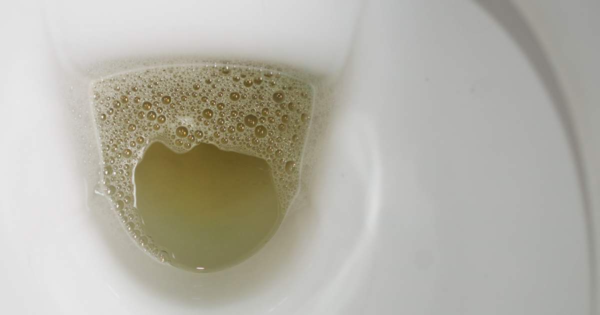 Tohle se děje s vaším tělem, pokud se na hladině moči tvoří pěna