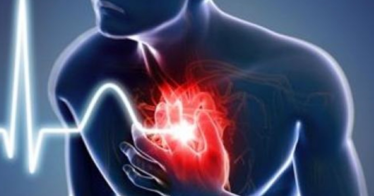 Tohle udělejte ihned po rozpoznání infarktu. Jde o klíčový krok