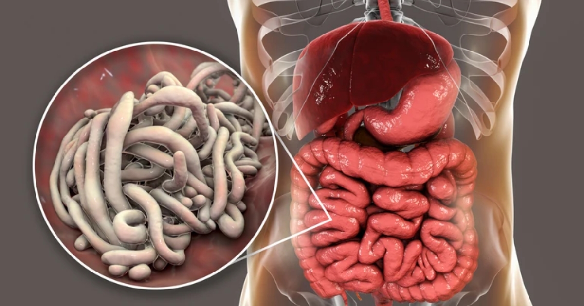 Pokud neprovádíte tuto očistu, vaše tlusté střevo doslova trpí