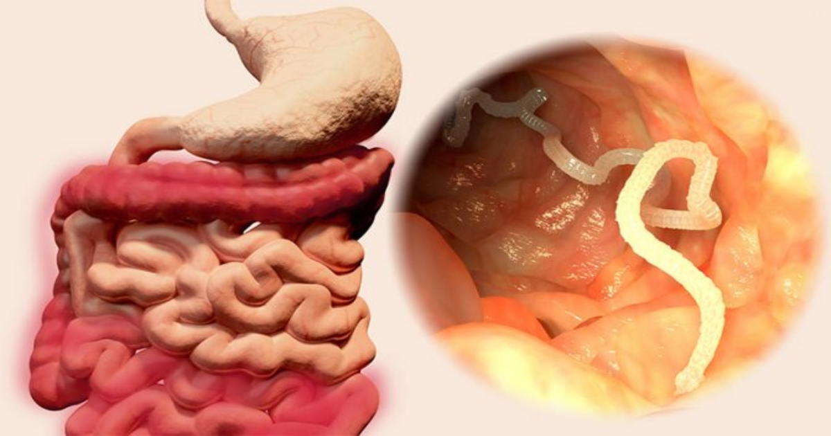 Zdravotní účinky této přírodní očisty od parazitů pocítíte ihned