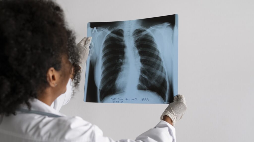 Klíčové příznaky rakoviny plic, které většina pacientů přehlíží